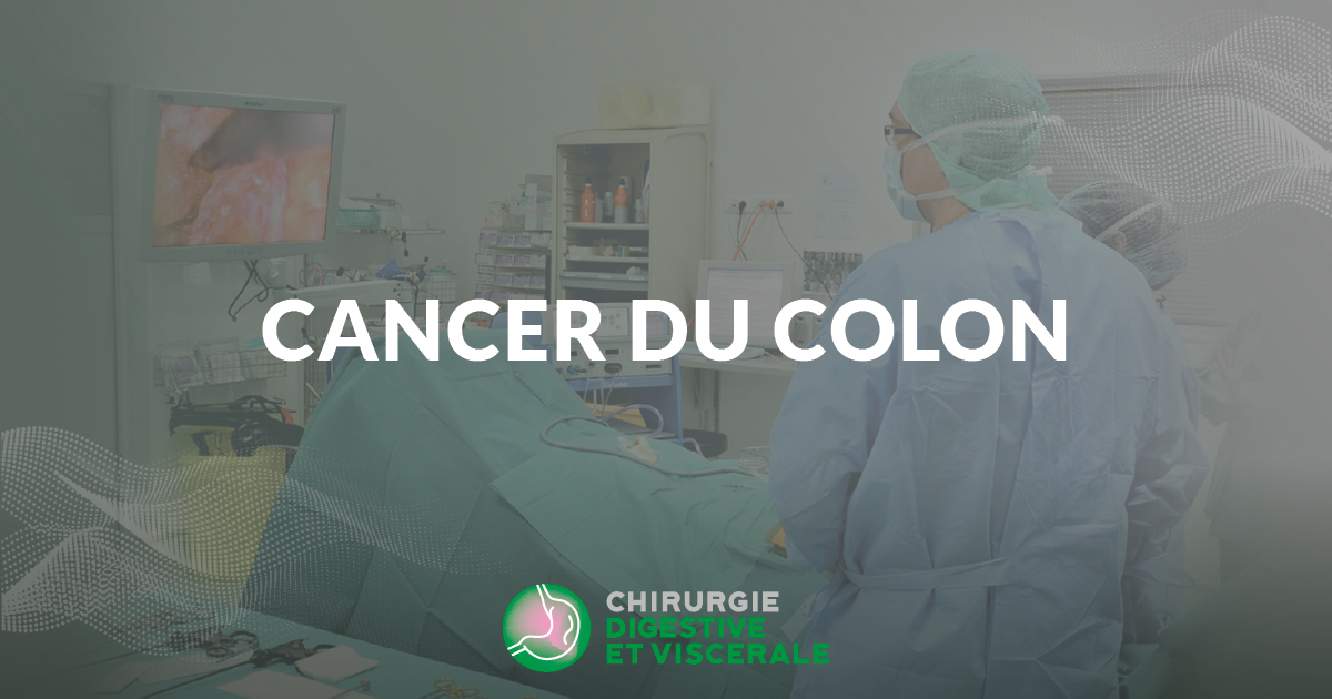 Cancer Du Colon Opération Chirurgicale – INCV