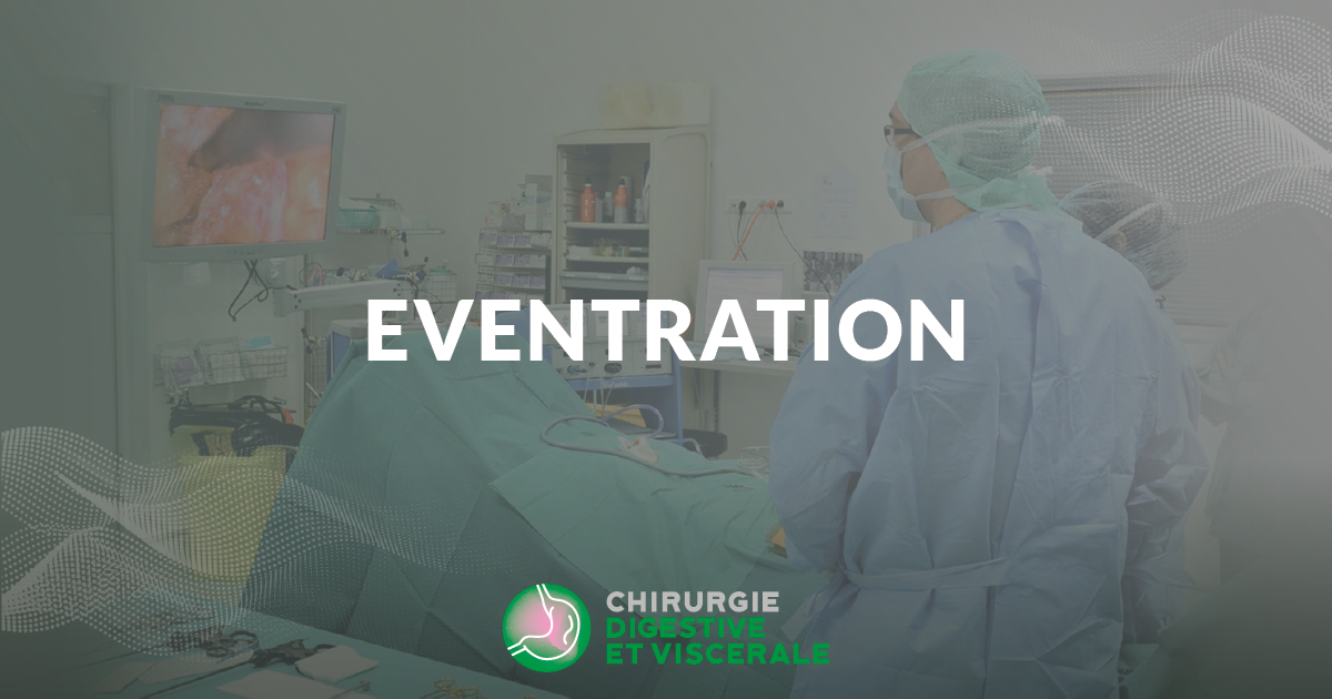 eventration - Clinique chirurgie digestive royan