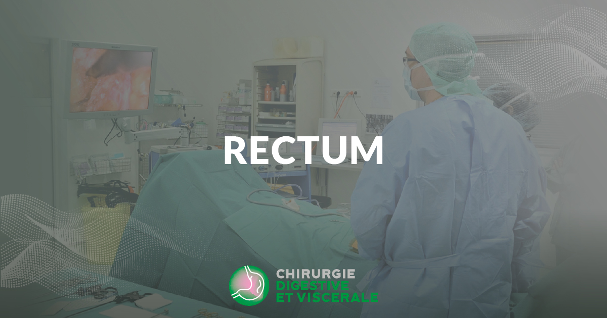Rectum - Clinique chirurgie digestive royan