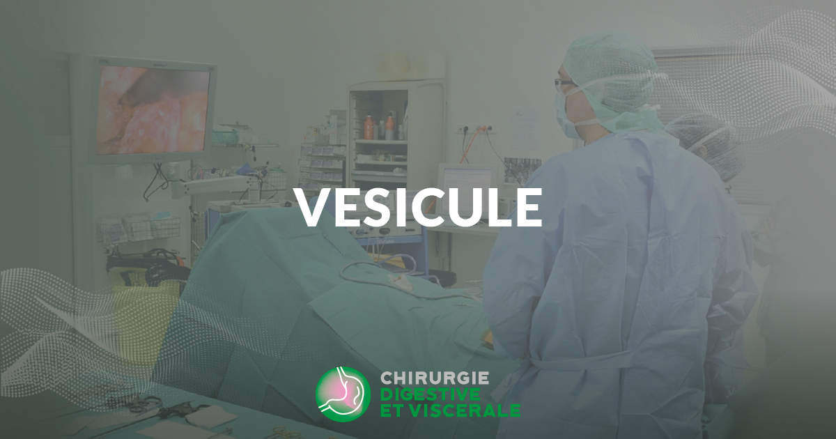 Vesicule - Clinique chirurgie digestive royan